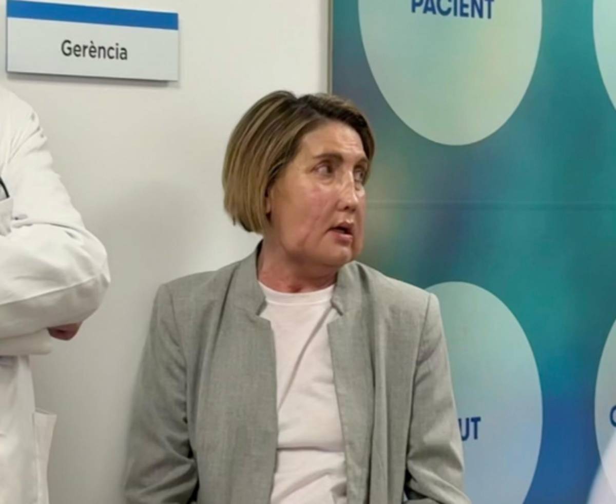 Vall d'Hebron sets a world milestone: first face transplant thanks to a ...