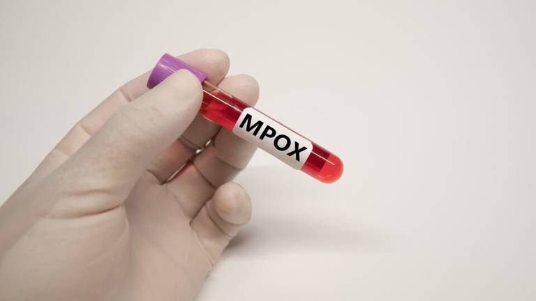 Mpox: São Paulo tem aumento de casos; saiba como se proteger